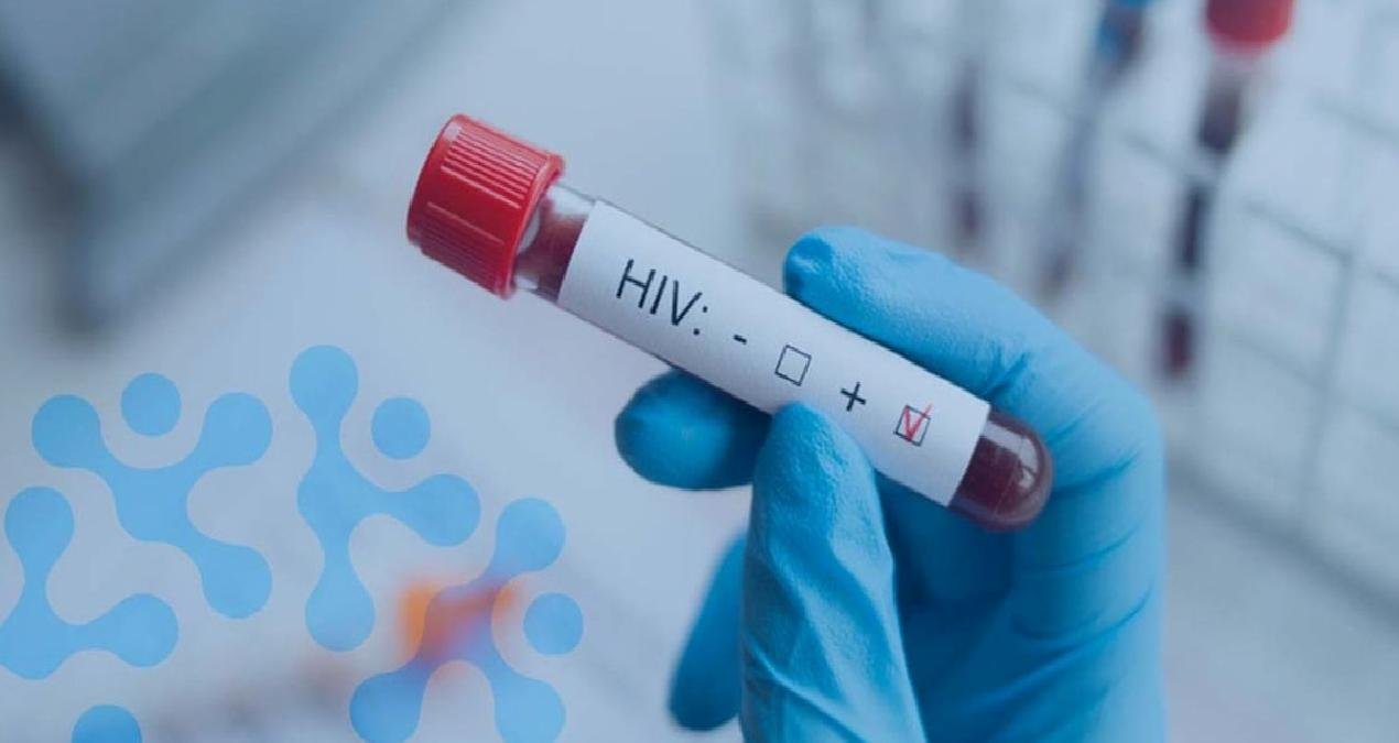 HIV tedavisinde devrim niteliğinde yöntem: ‘Hepimizi şaşkına çevirdi ...